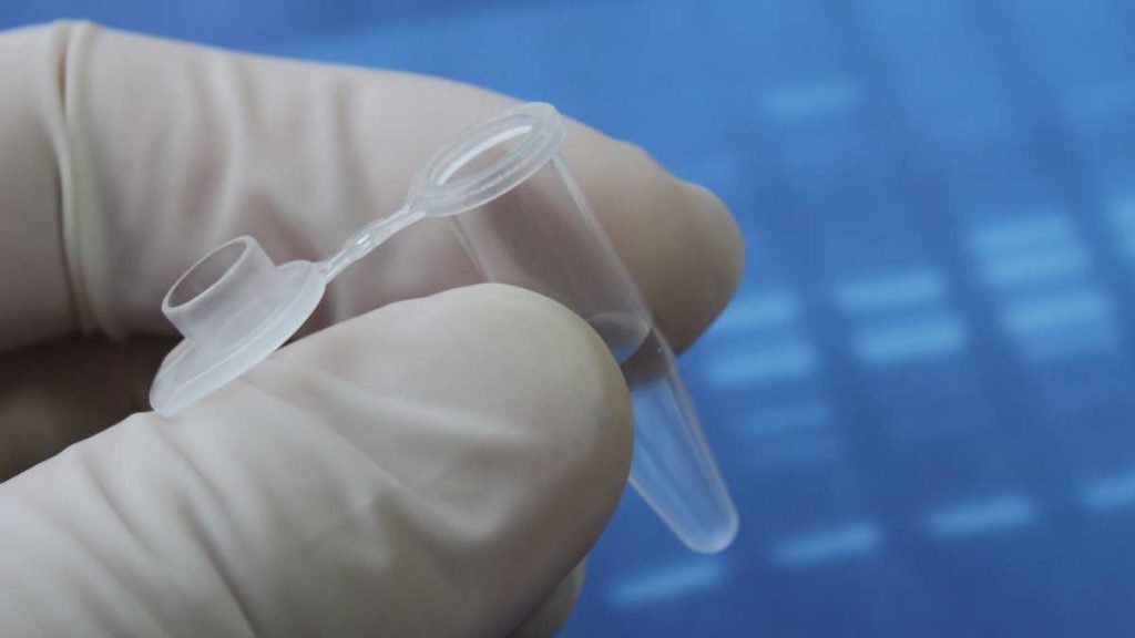 How To Do A DNA Test Without The Father Digital Health Central